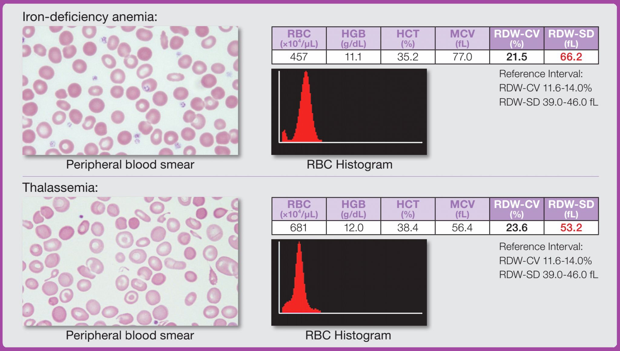 Celltac Es MEK-7300 da Nihon Kohden: analisador hematológico para ...