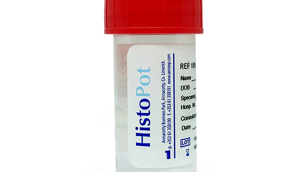 Lançamento do HistoPot 40 ml, para biopsias pequenas | Newslab