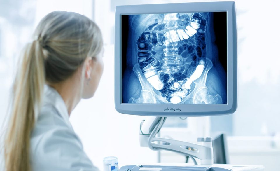 Ferramenta pode auxiliar o diagnóstico por imagem de enterocolite ...