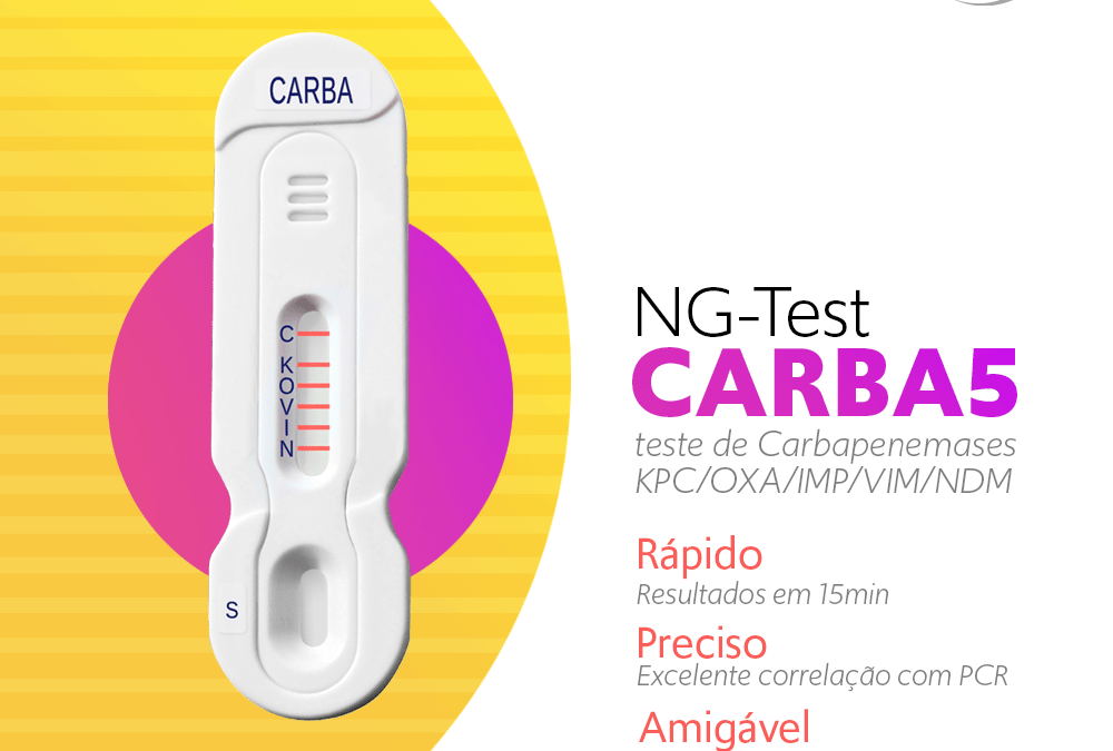 Ng Teste Carba 5 | Newslab
