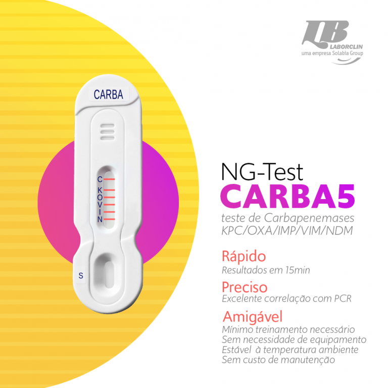Ng Teste Carba 5 | Newslab