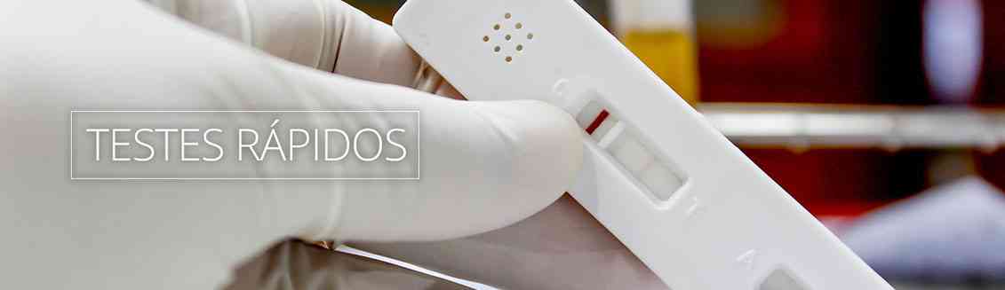 Sangue Oculto (FOB) - Teste Rápido Ebram | Newslab