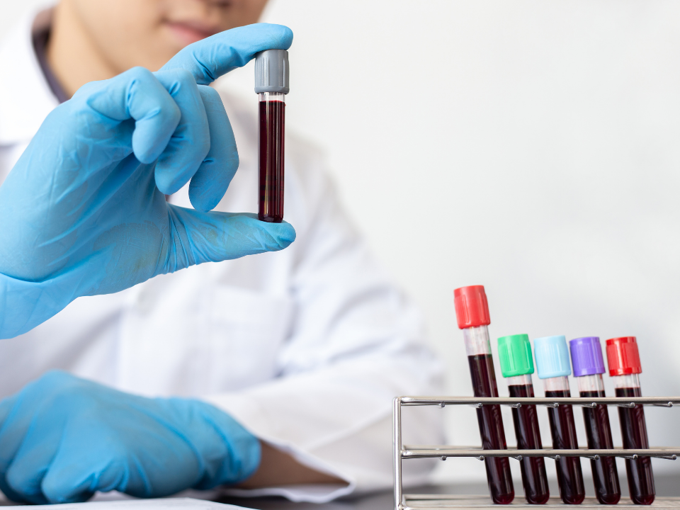 10 Exames De Sangue Que Devem Fazer Parte Da Rotina Newslab 10 Exames De Sangue Que Devem Fazer Parte Da Rotina Newslab