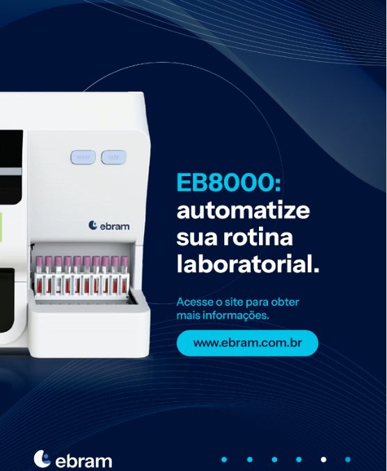 O EB8000 é o mais novo modelo de analisador hematológico 5 partes com ...