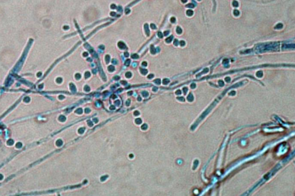 Lonomia: saiba reconhecer a lagarta que pode provocar envenenamento ...